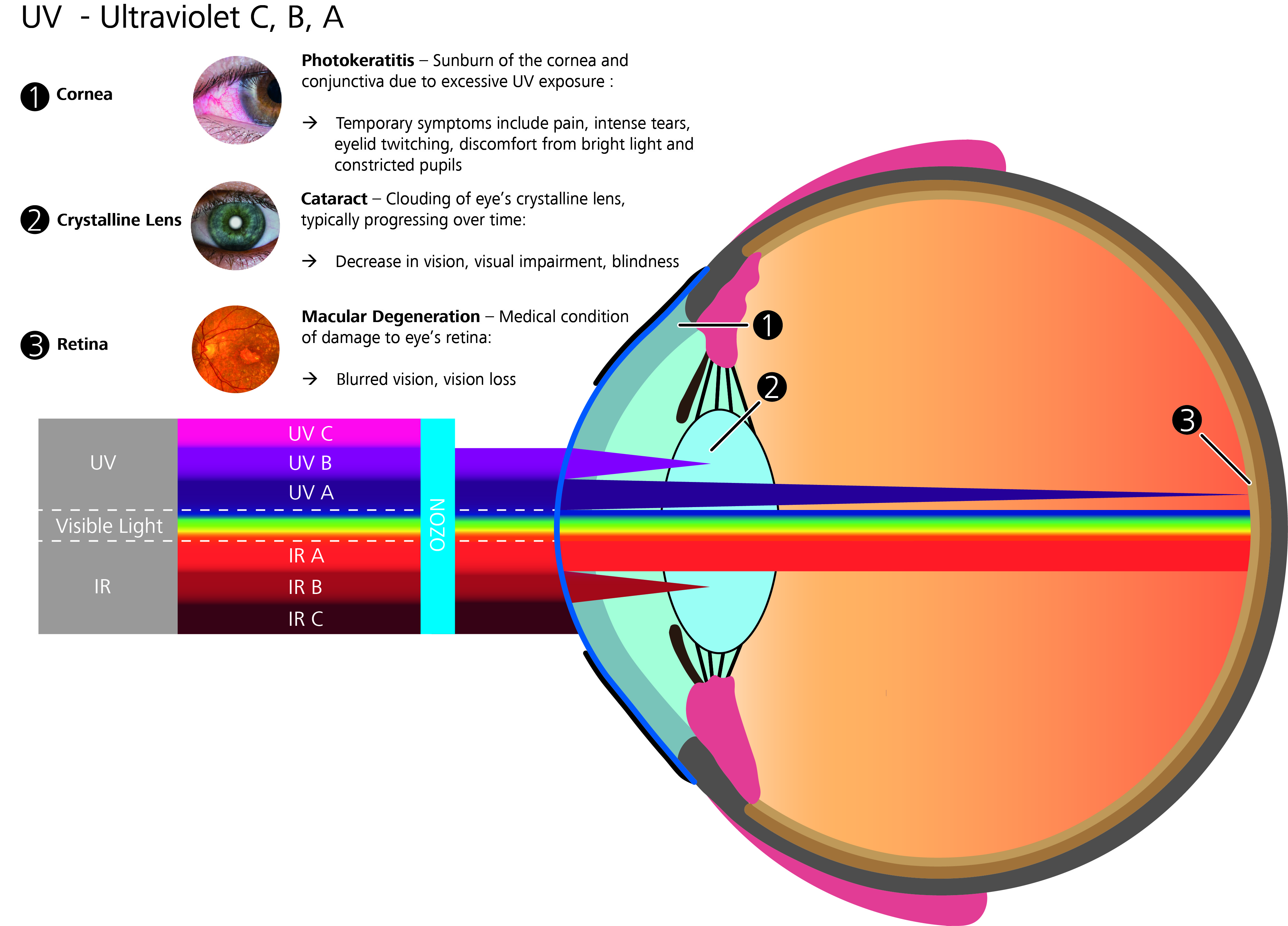 ZEISS Eyeglass Lenses Available with Full UV Protection Beginning in 2018 ZEISS Eyeglass Lenses Available with Full UV Protection Beginning in 2018