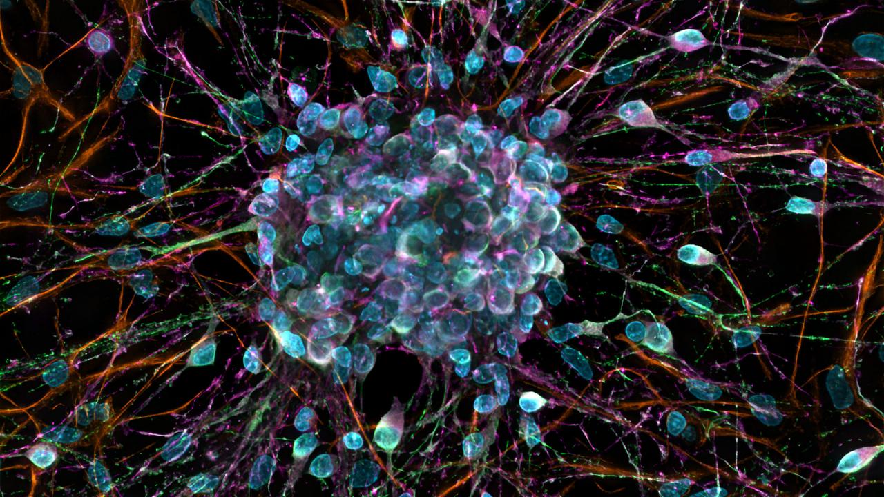 fluorescence microscopy bacteria