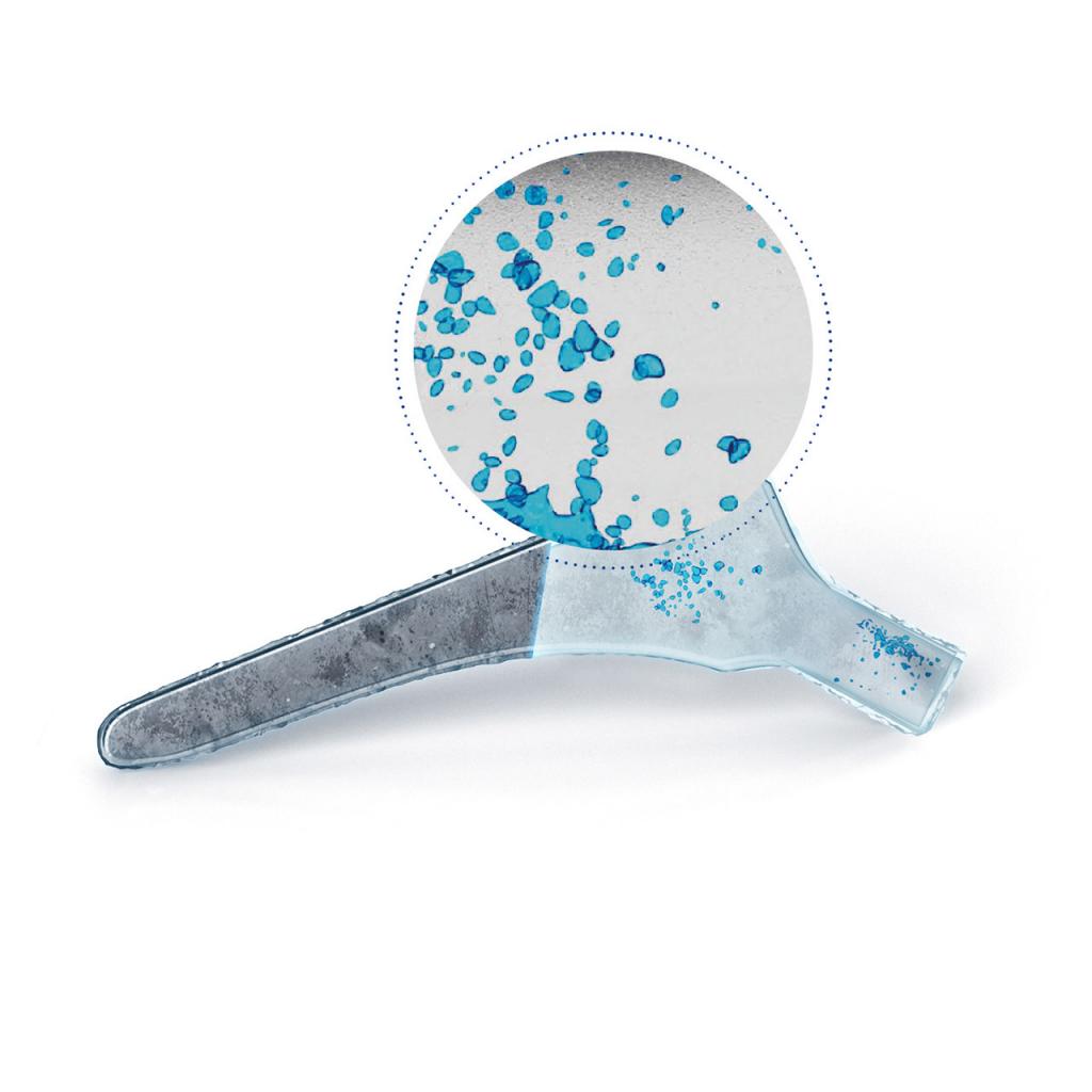 Quality assurance for orthopedic implants | high-precision, efficient