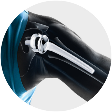 Quality assurance for orthopedic implants | high-precision, efficient