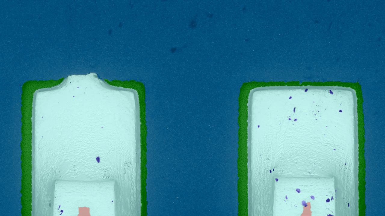 Deep learning for complex image processing | ZEISS