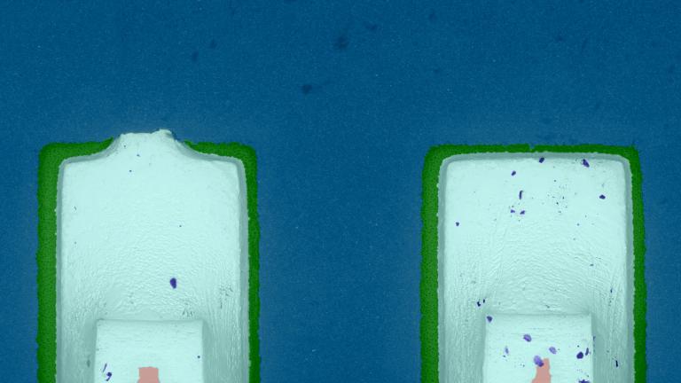 Deep learning for complex image processing | ZEISS