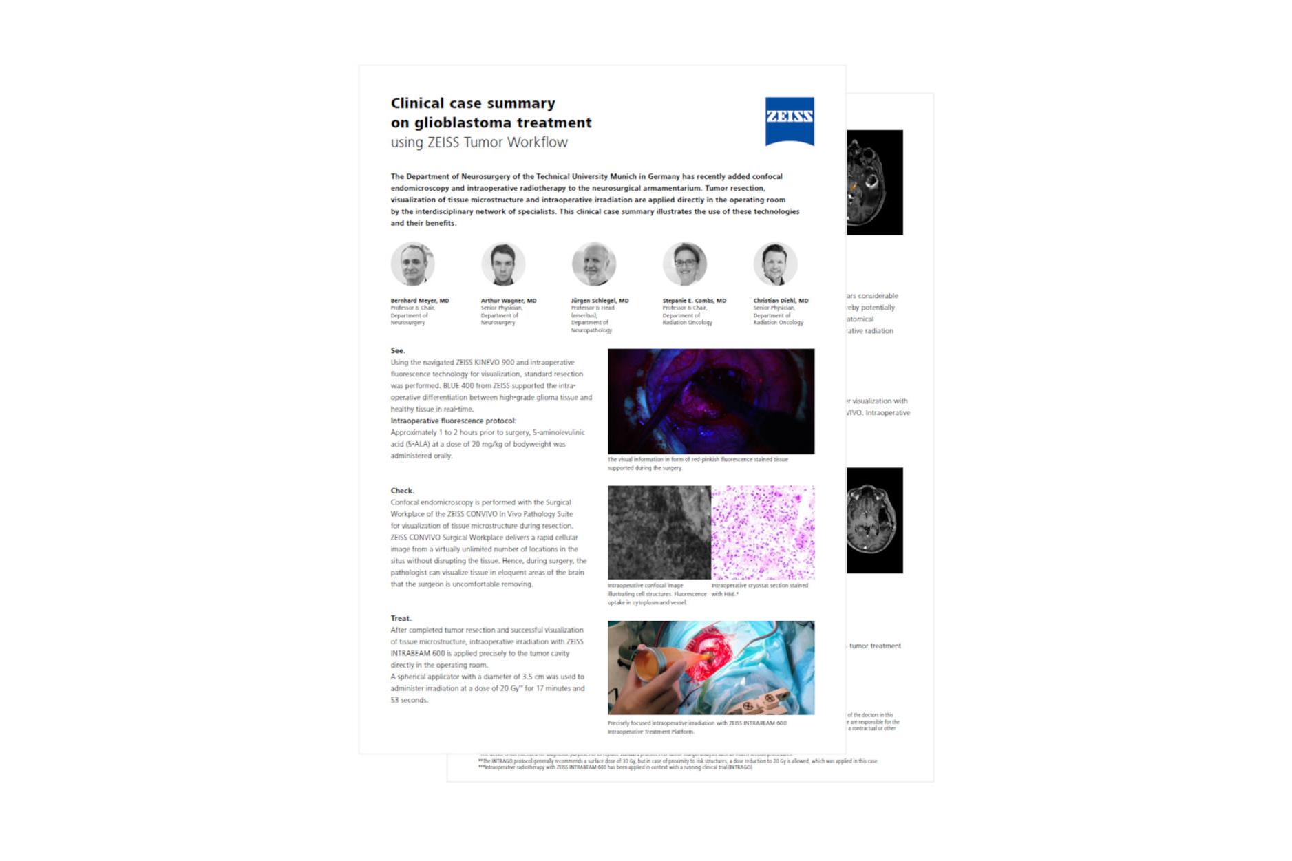 Zeiss Tumor Workflow Multidisciplinary Brain Tumor Treatment