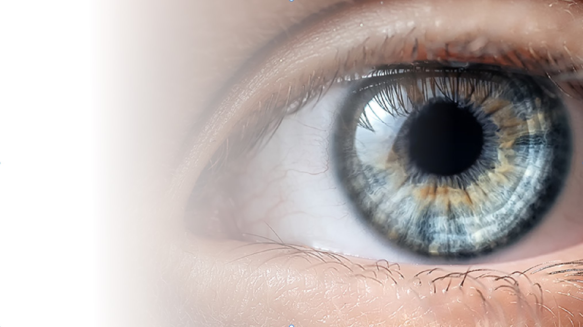 ZEISS CLARUS clinical cases