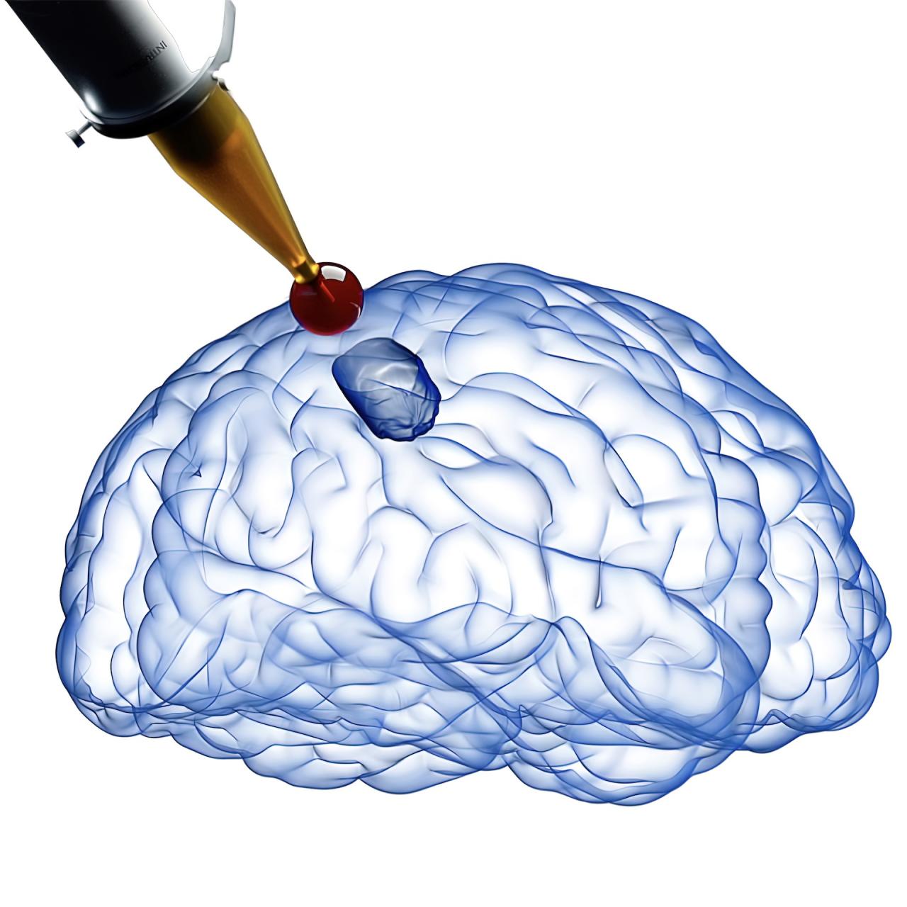 Clinical insights into intraoperative radiotherapy (IORT) for the ...