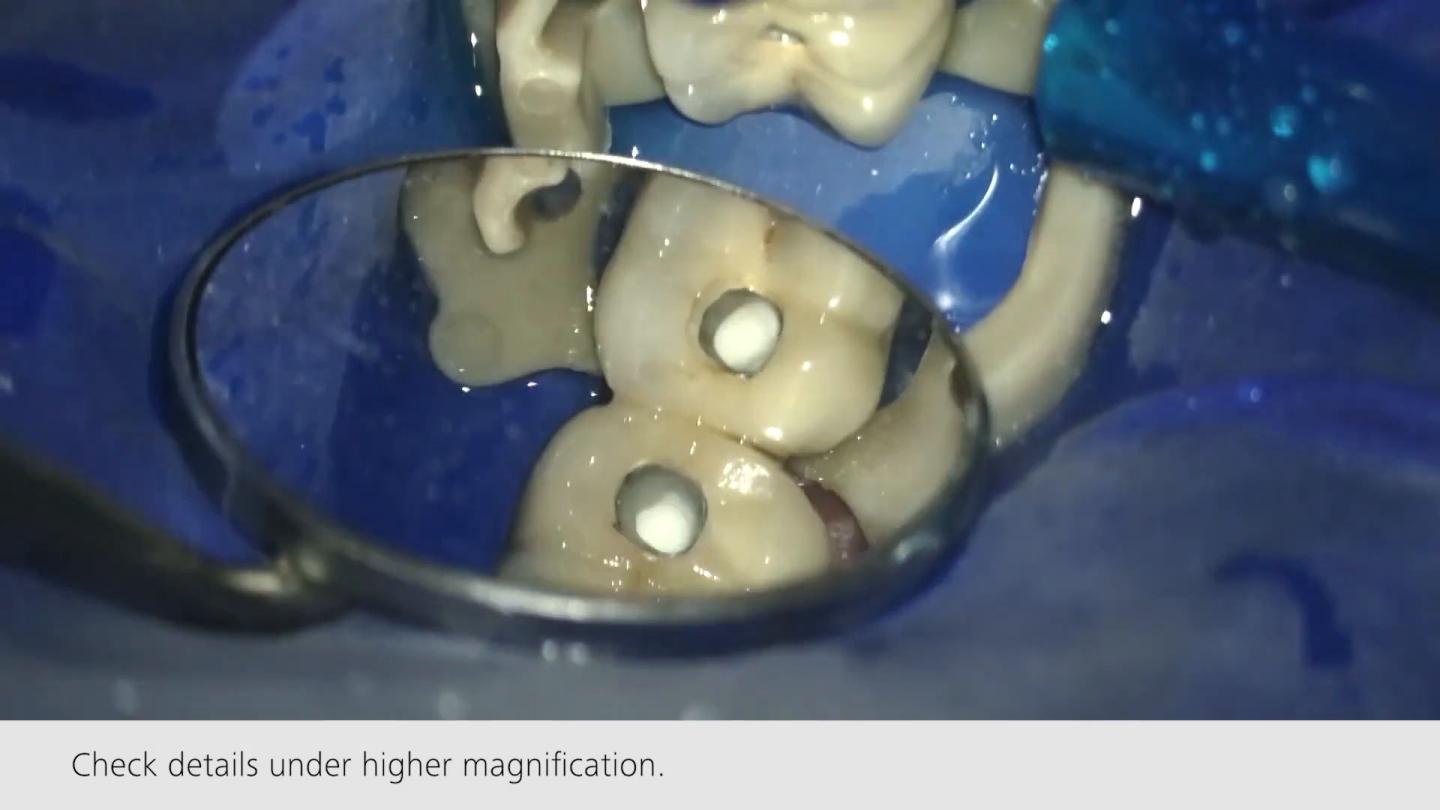 Take a comprehensive look at the decisive role high magnification.