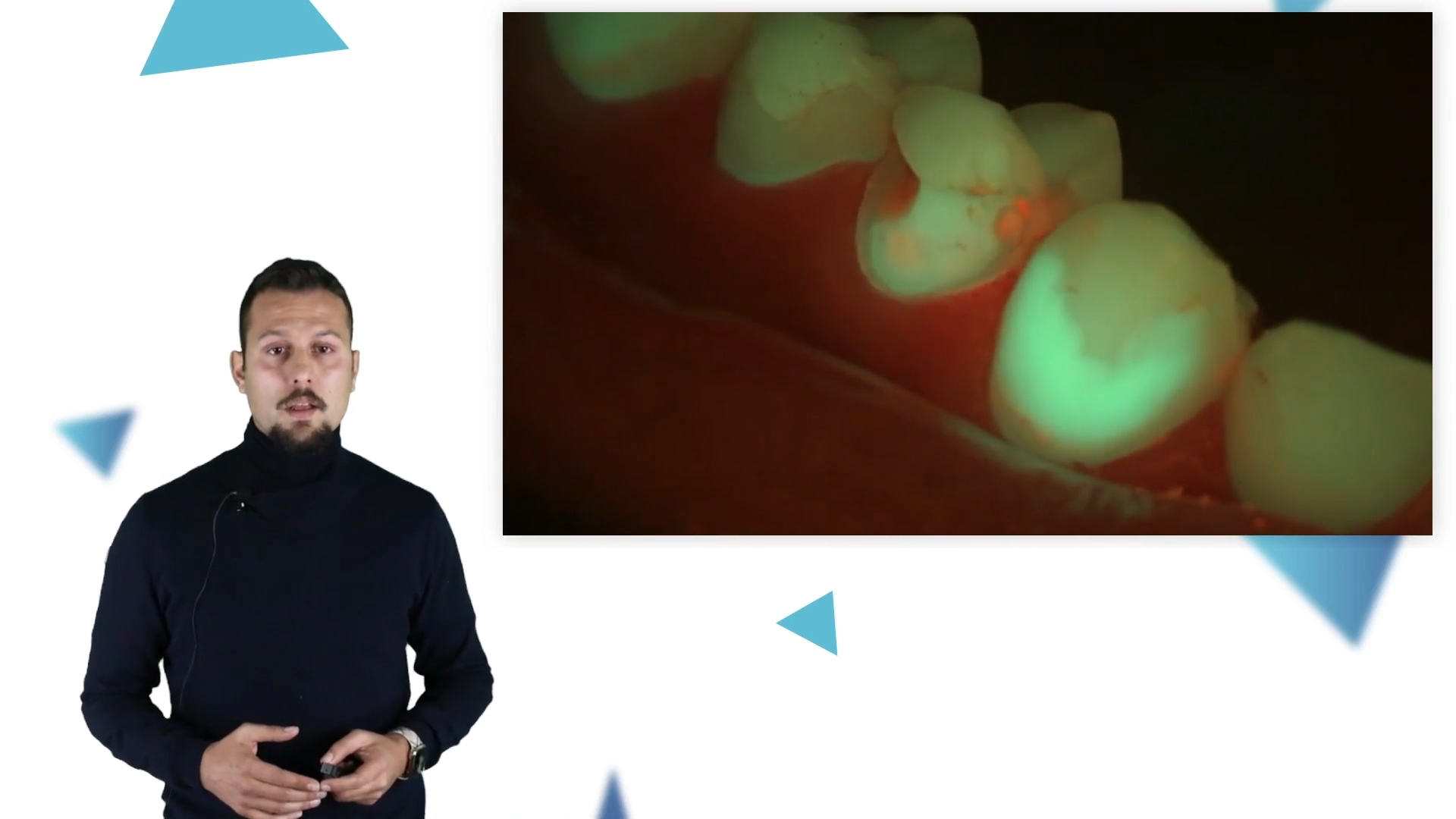 Microscope in dentistry: How to get the 300%.