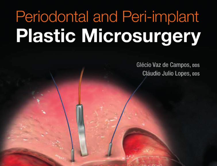 Periodontal and Peri-implant - Plastic Microsurgery