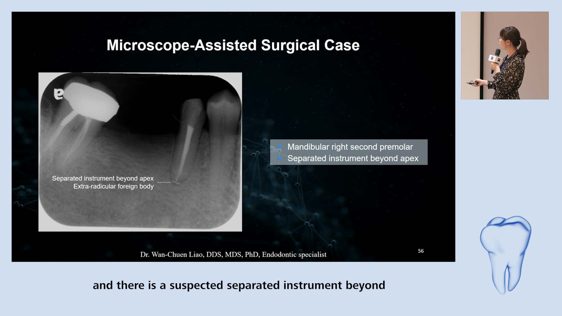 Empower Clinical Practice with the Micro-Endodontic Toolkit