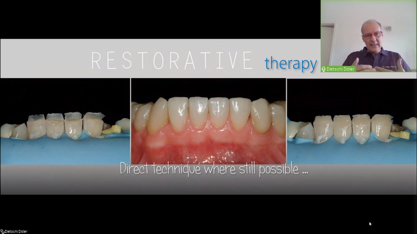 Interceptive and selective treatment of tooth wear: a conceptual and ...
