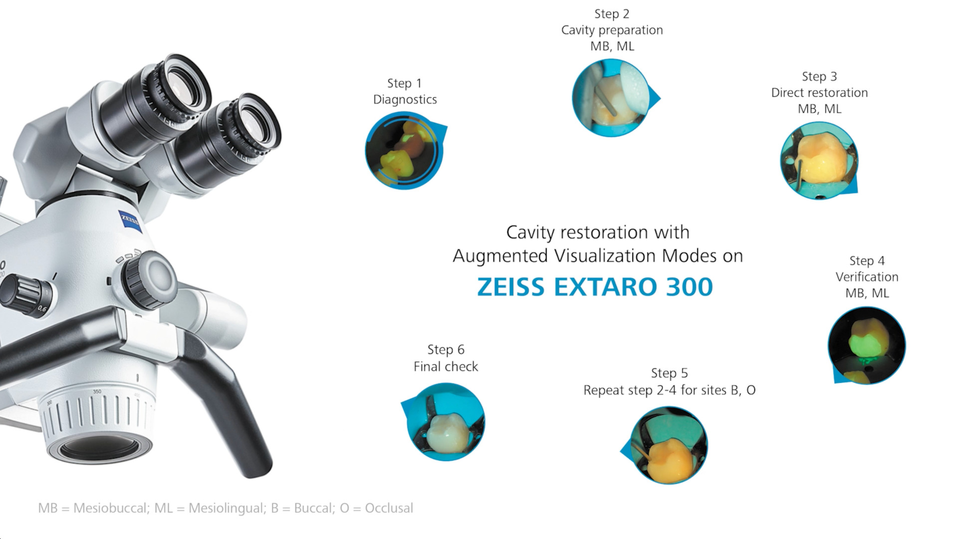 All restorative procedures require more precision