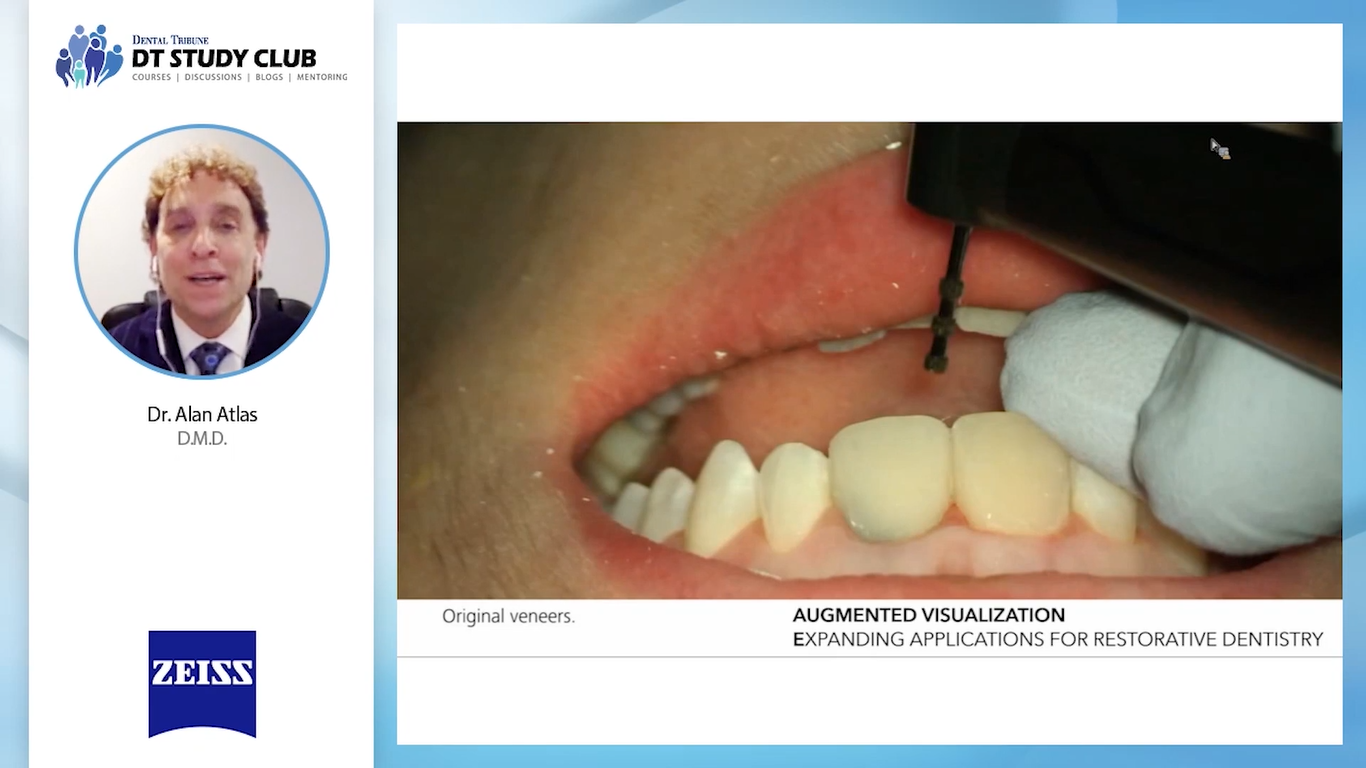 Precision and preservation through enhanced dental microscope visualization
