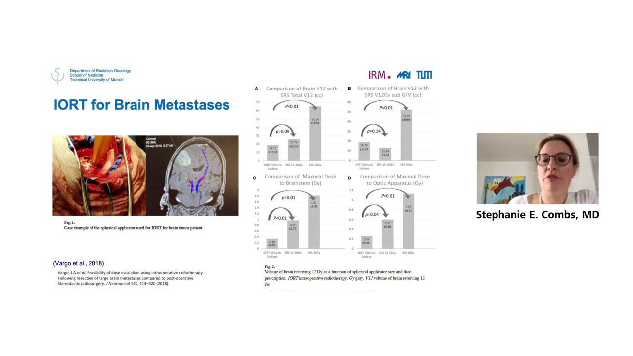 Treating brain metastases with IORT – rationale, guideline & clinical ...