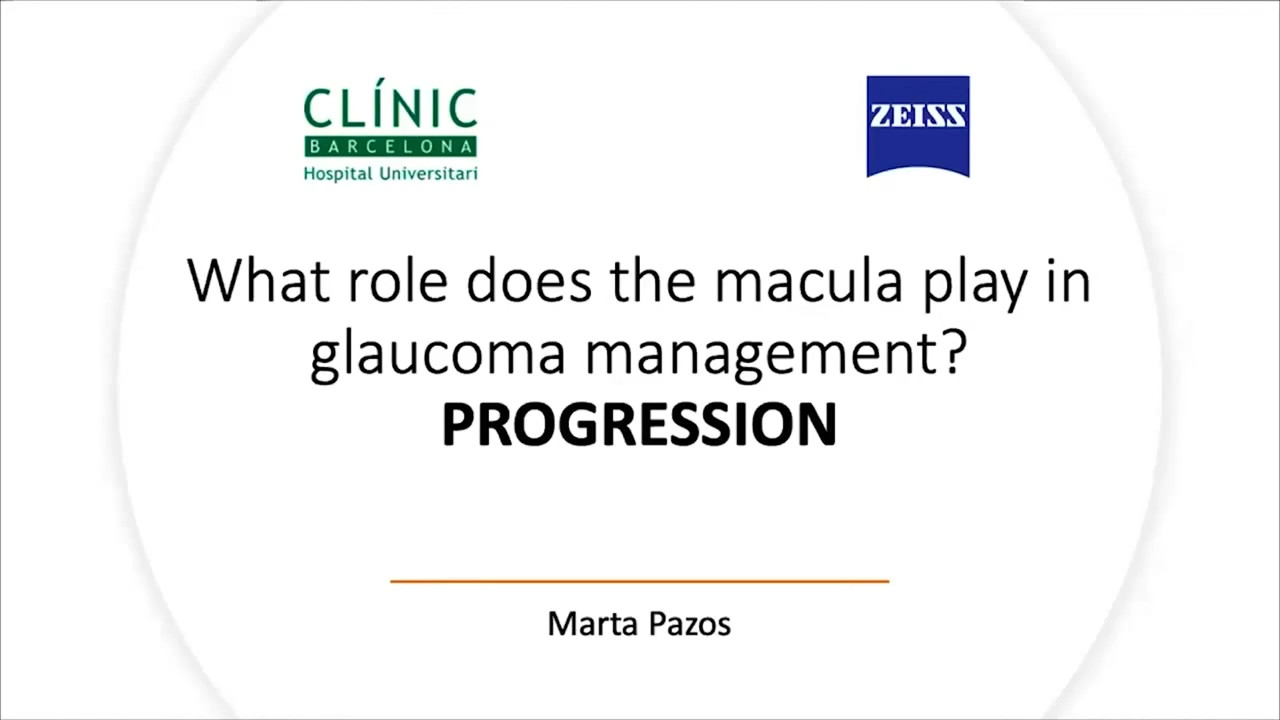What role does the macula play in glaucoma management?