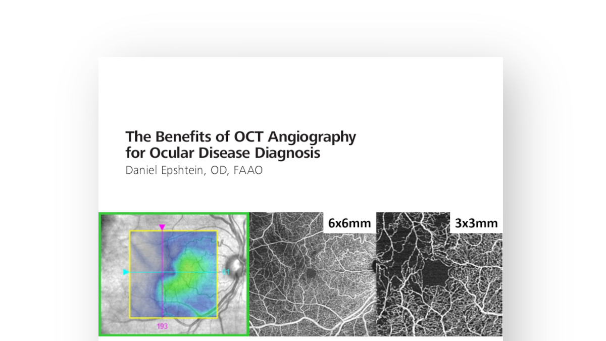 The Benefits of OCT Angiography for Ocular Disease Diagnosis