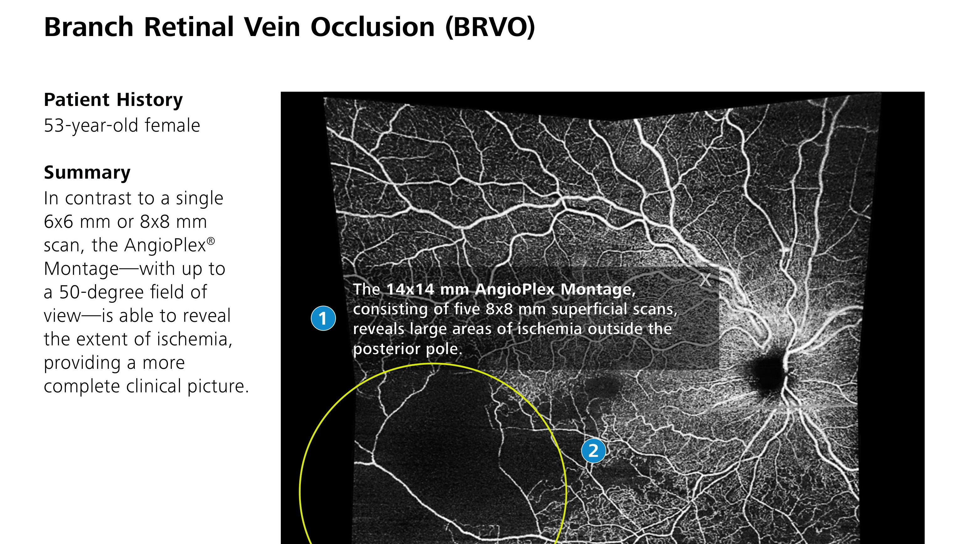 Interpretation Guide OCT Angiography and integrated diagnostic imaging