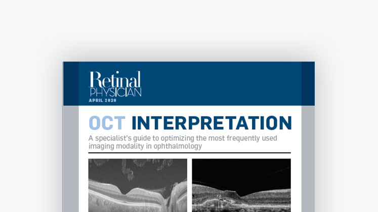 OCT Interpretation: A specialist's guide to optimizing the most ...