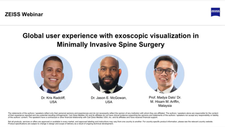 Exoscopic visualization in spine surgery