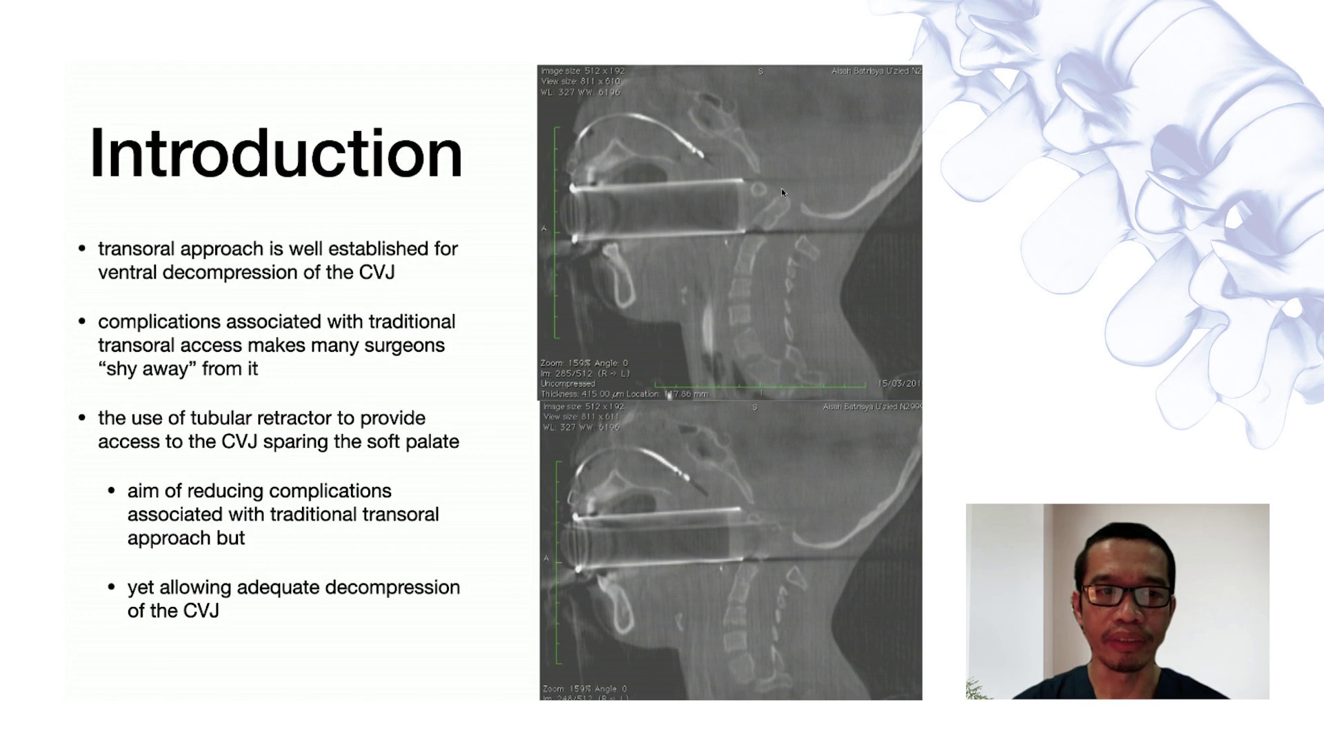 Minimally invasive transoral approach for ventral cvj