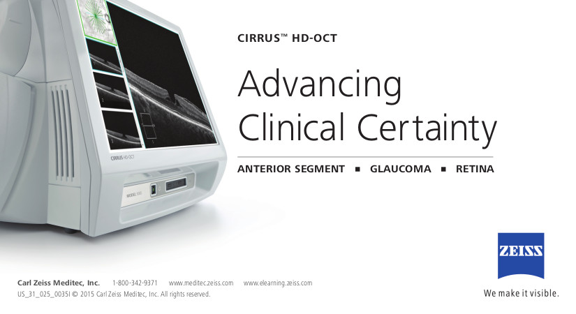 ZEISS CIRRUS OCT - Interpretation of retinal layers of a B-scan
