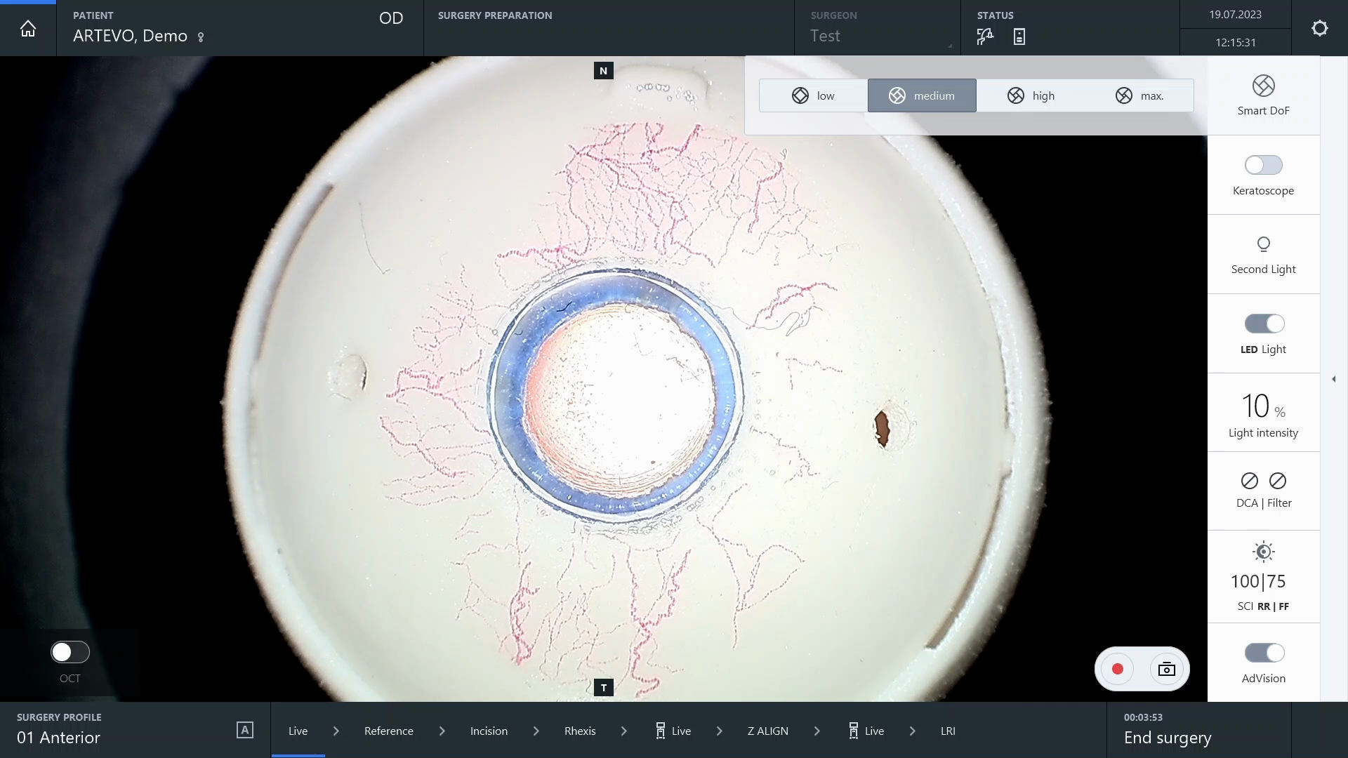 How to use Smart Depth of Field on ZEISS ARTEVO 850 with ZEISS CALLISTO 5.0