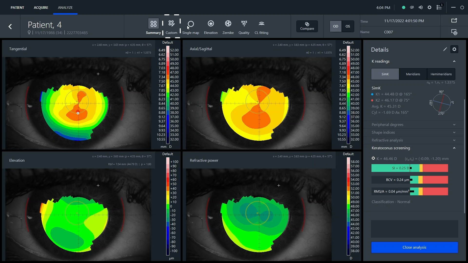 ZEISS ATLAS 500 - Corneal topography