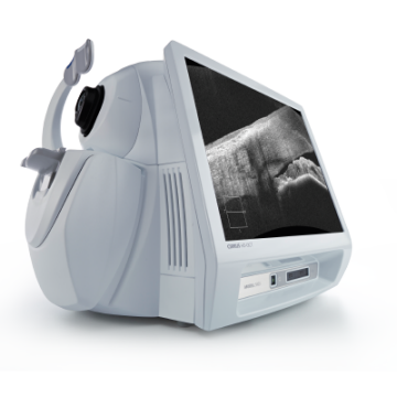 ZEISS CIRRUS OCT - Interpretation of retinal layers of a B-scan