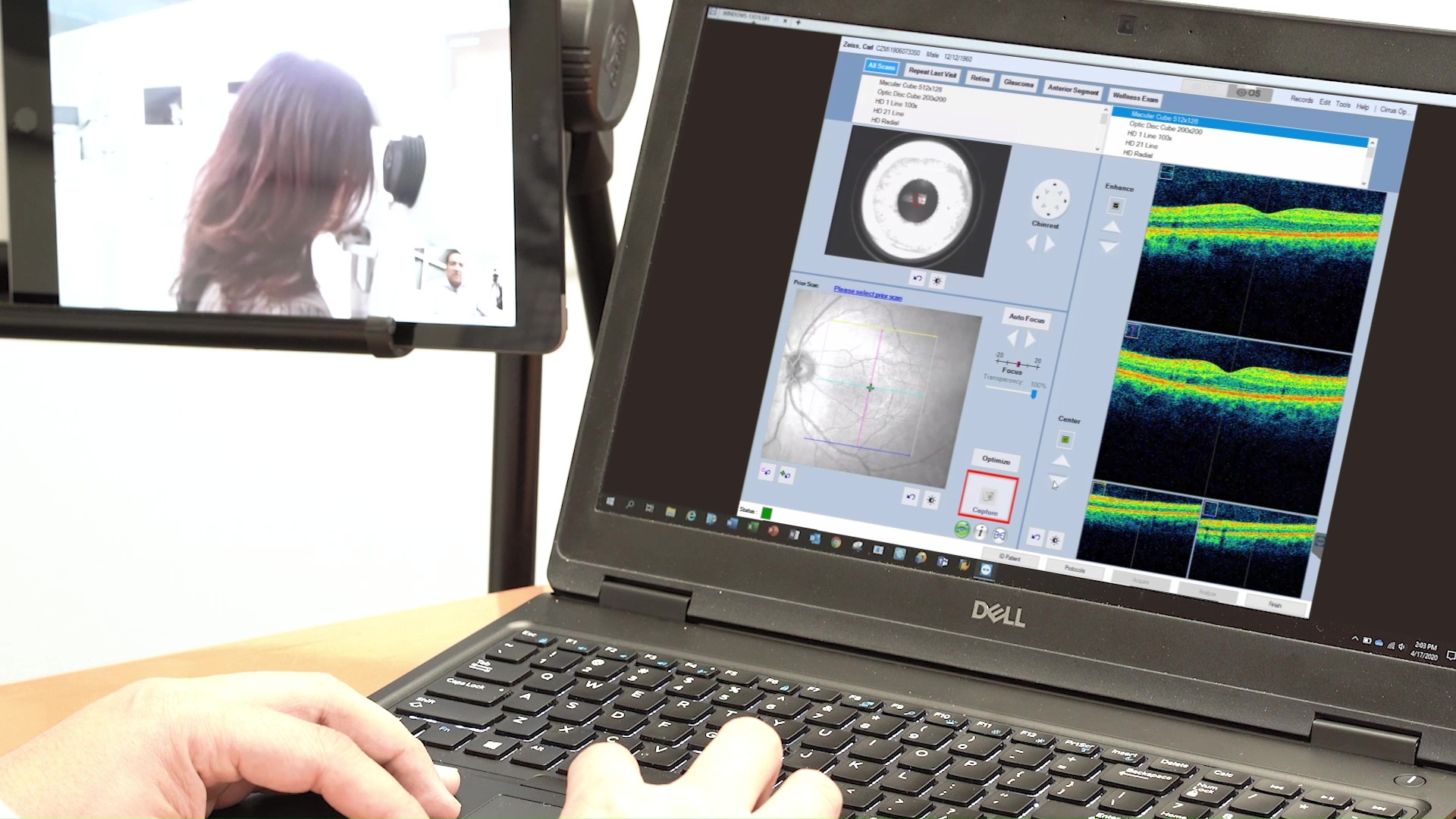 How To Perform An Oct Exam With A Remote Connection To The Cirrus Oct