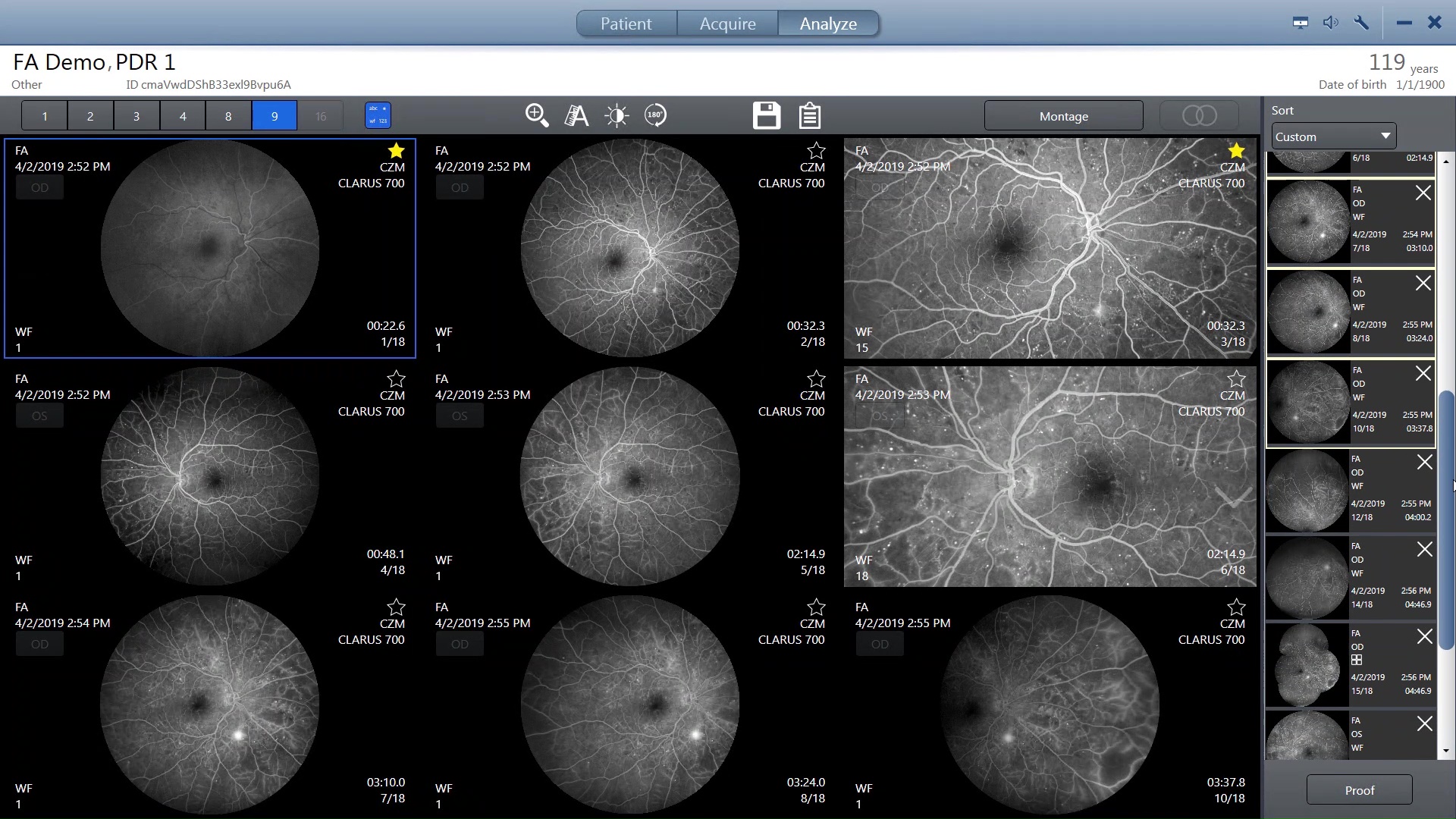 How to capture and review a Fluorescein Angiography or FA image series ...