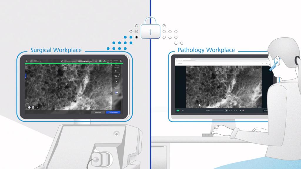 ZEISS CONVIVO In Vivo Pathology Suite