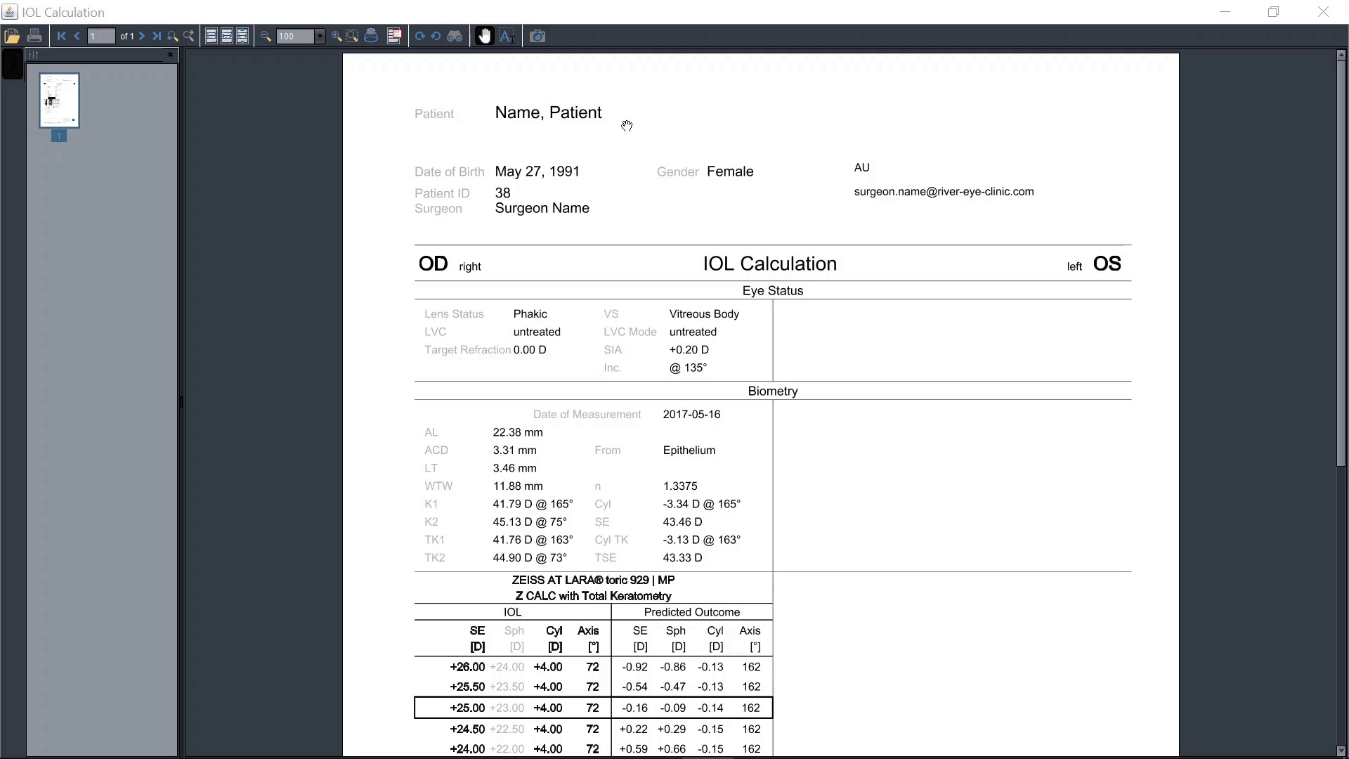 How to access the IOL Calculation PDF in ZEISS EQ Workplace