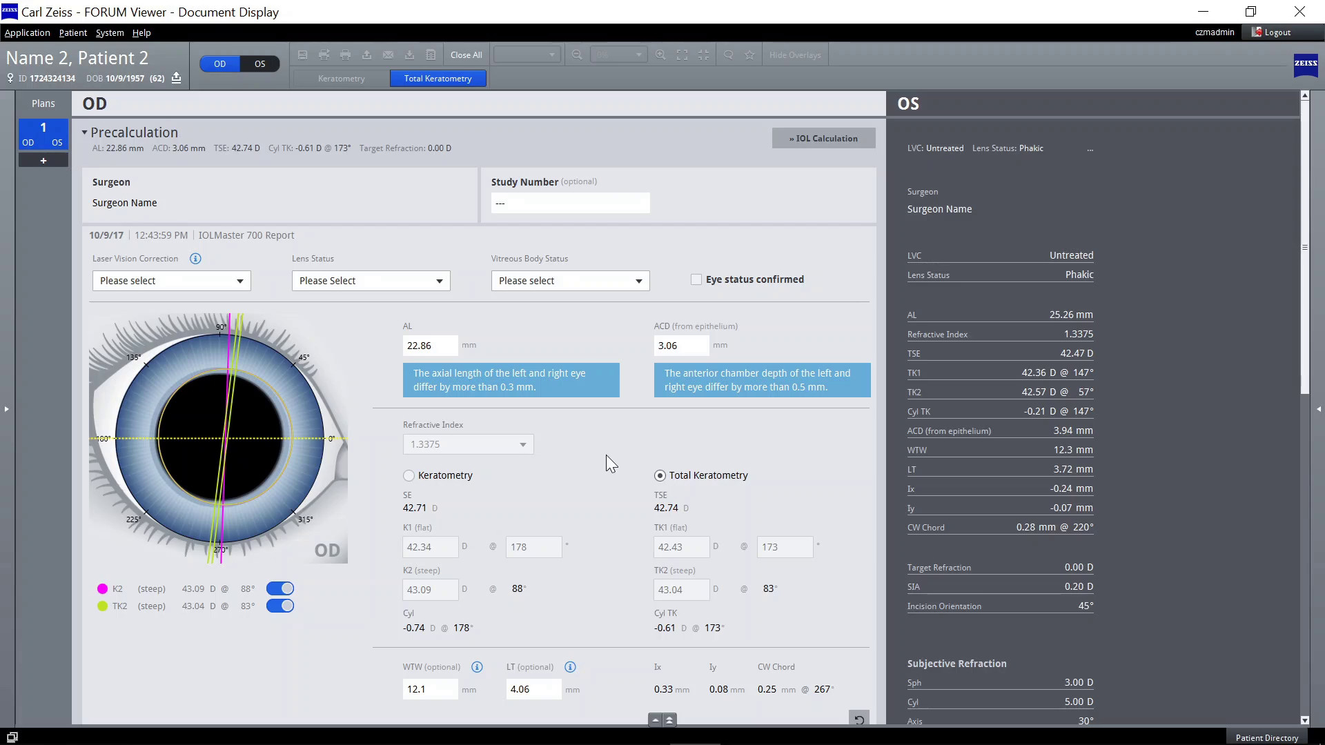 How to select IOLMaster report in ZEISS EQ Workplace