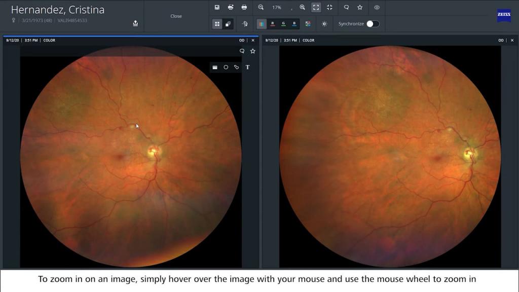 FORUM ophthalmology software