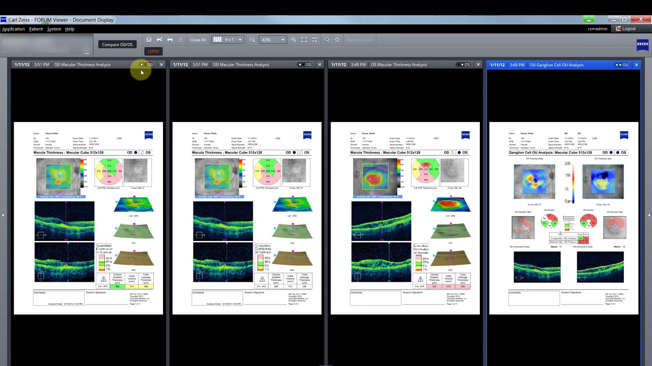 ZEISS FORUM 4.2 Basic functions