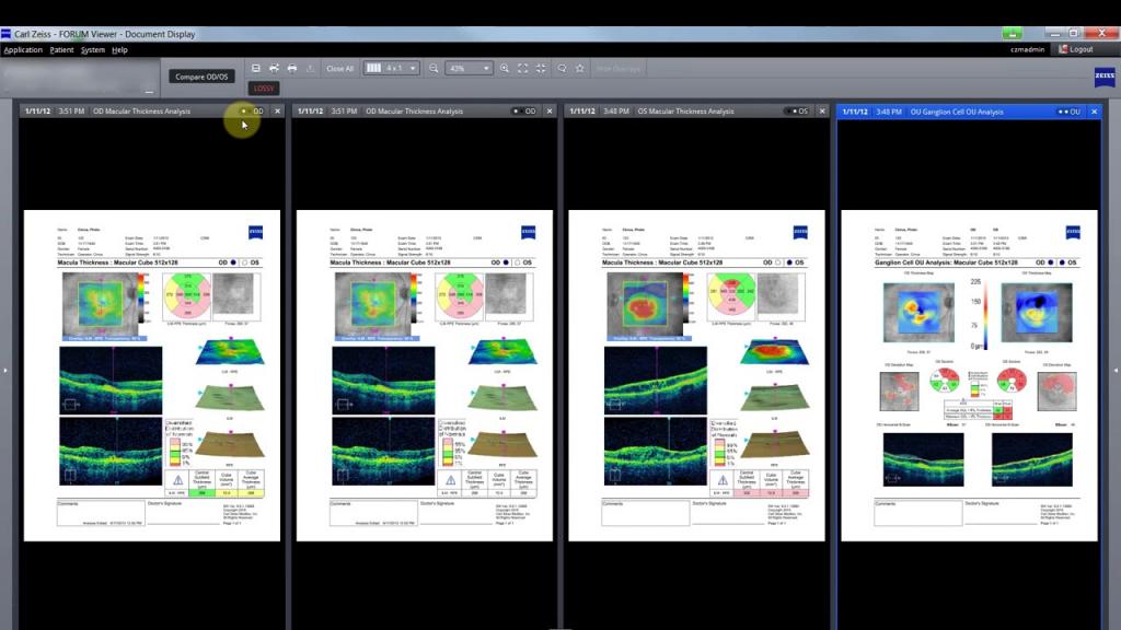 ZEISS FORUM 4.4 + Advanced review tools