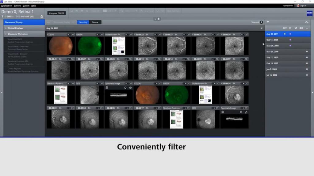 ZEISS FORUM 4.4 + Advanced review tools