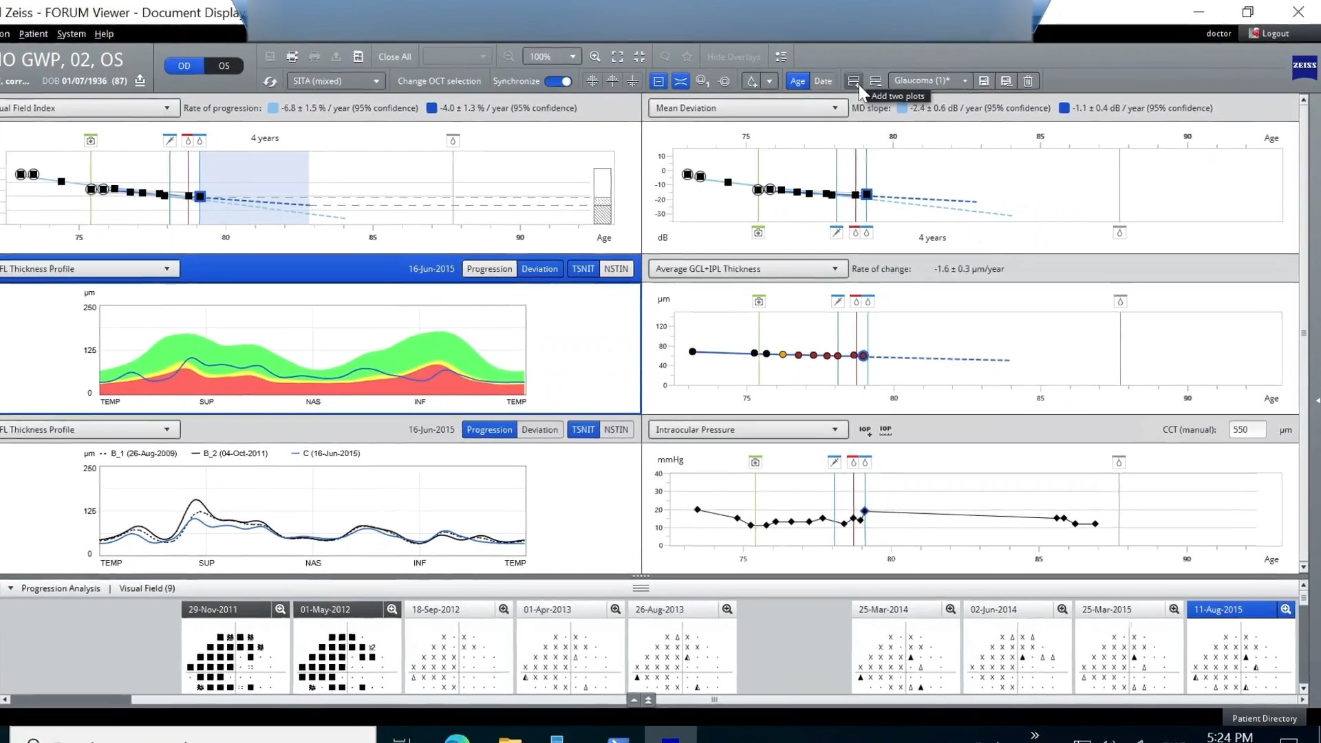 In 30 seconds: How to use ZEISS Glaucoma Workplace progression graphs