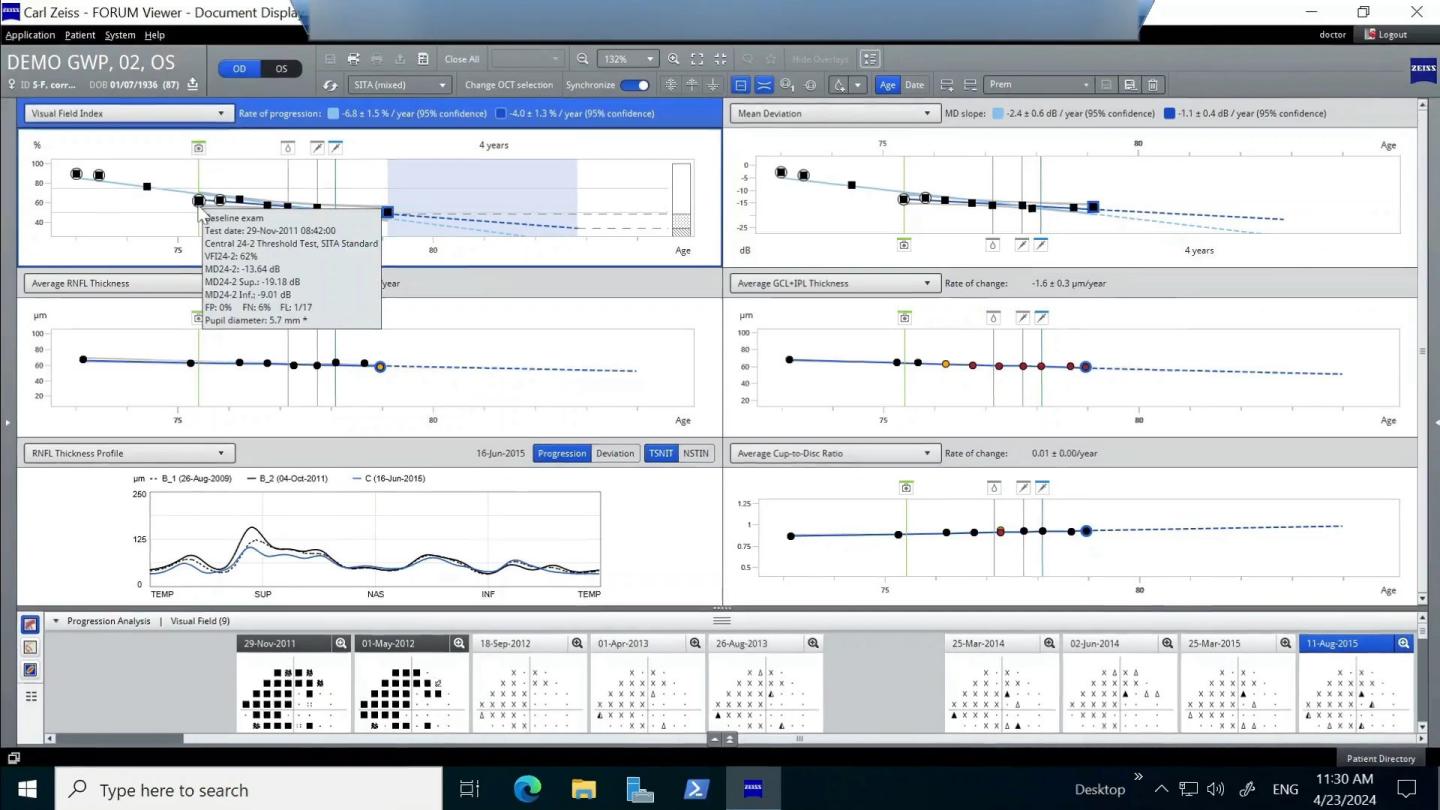 In 30 seconds: How to use ZEISS Glaucoma Workplace progression graphs
