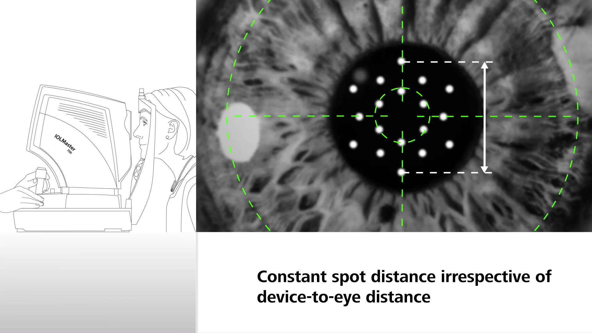 ZEISS IOLMaster 700 and Telecentric Keratometry