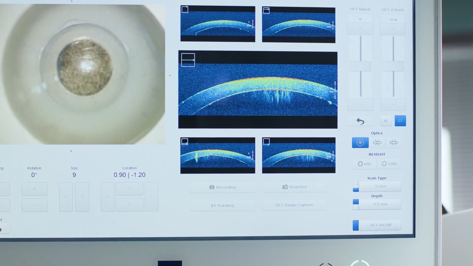 How to achieve a good OCT signal in anterior applications