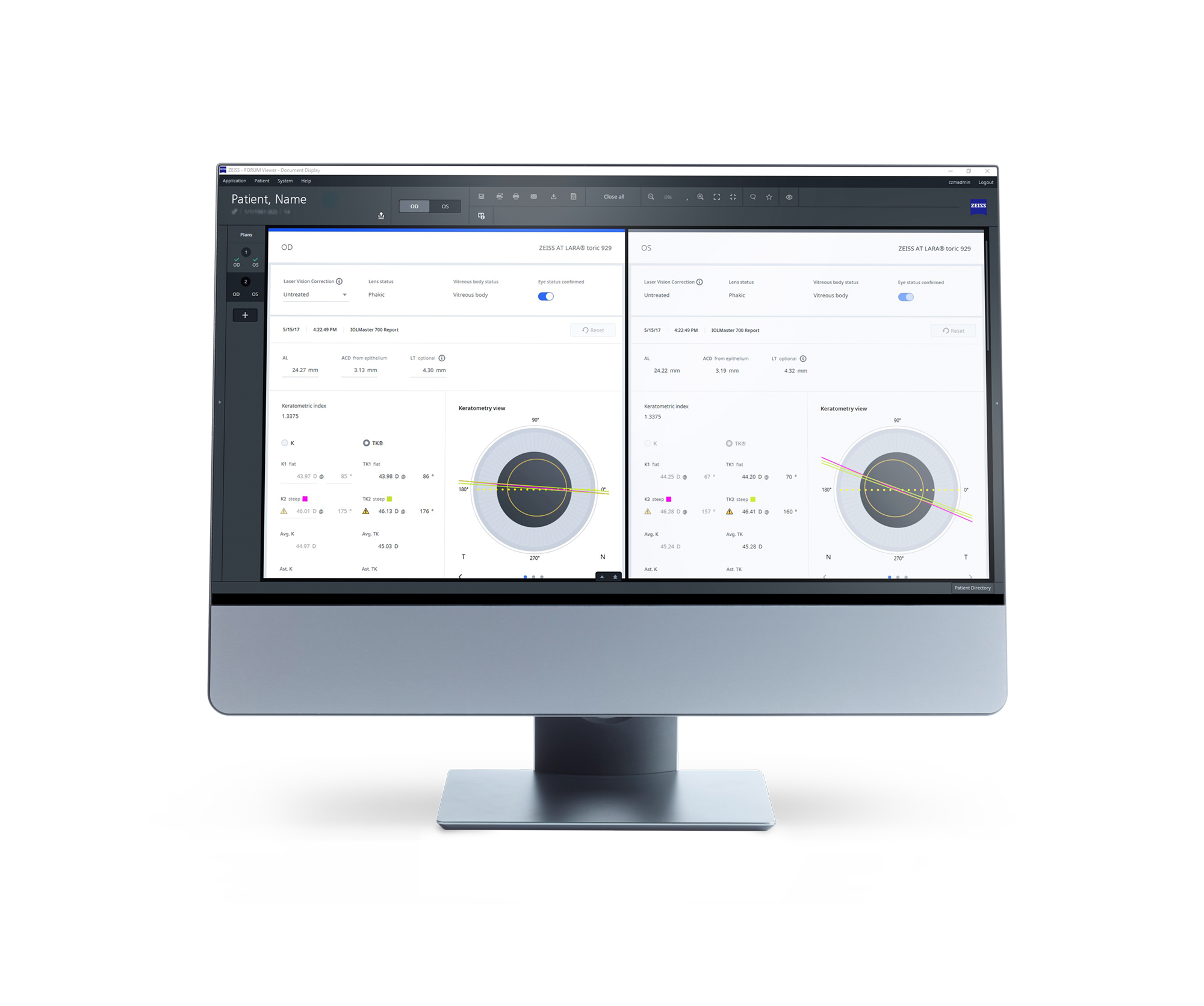 ZEISS EQ Workplace | ZEISS Medical Technology