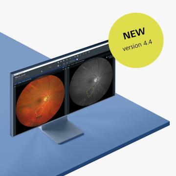ZEISS FORUM 4.4 ophthalmology software