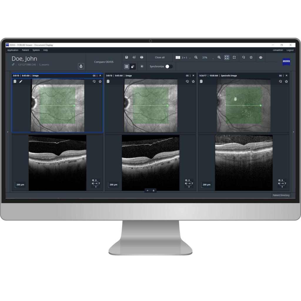 FORUM ophthalmology software