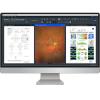 FORUM ophthalmology software