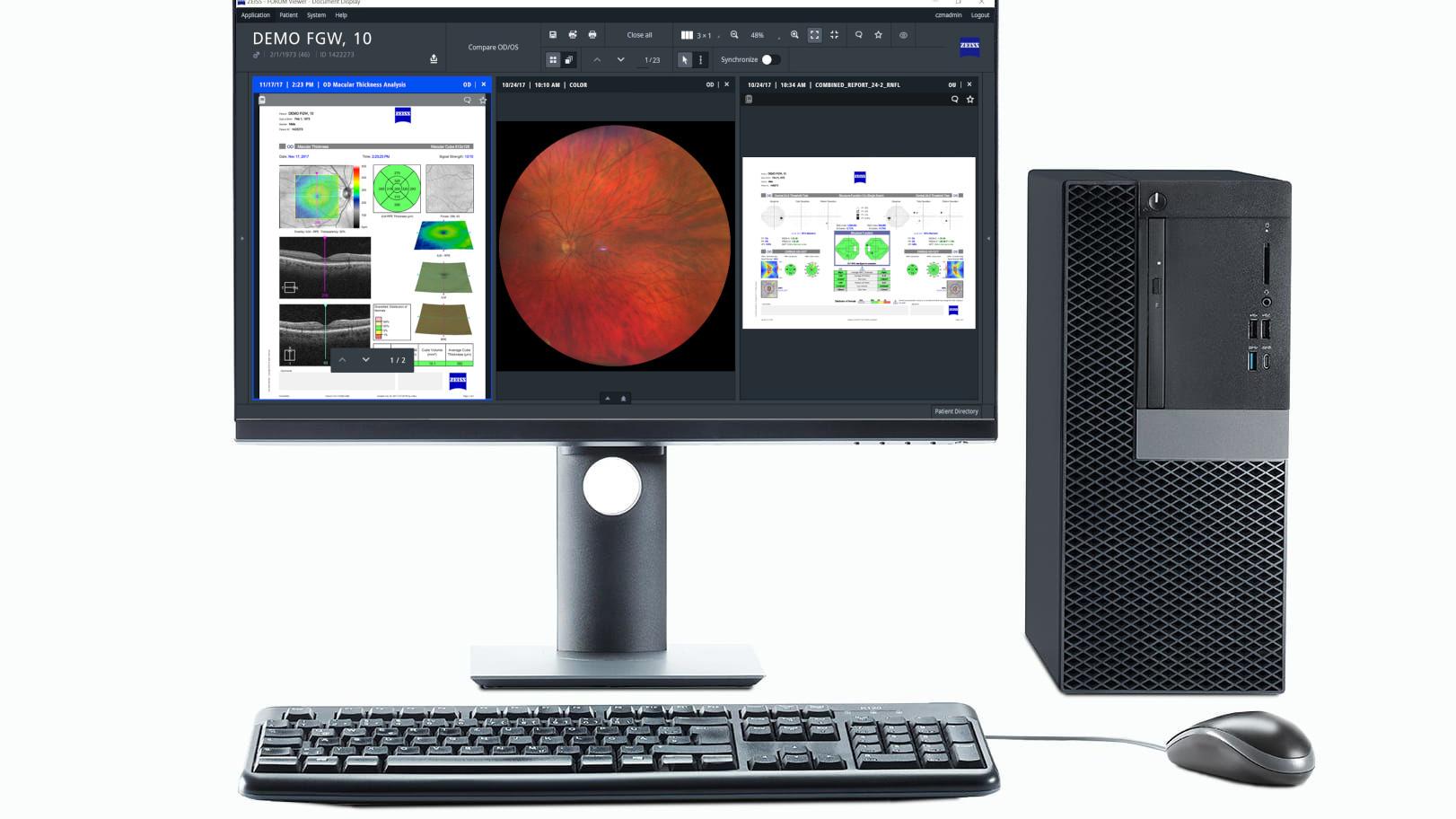 FORUM ophthalmology software