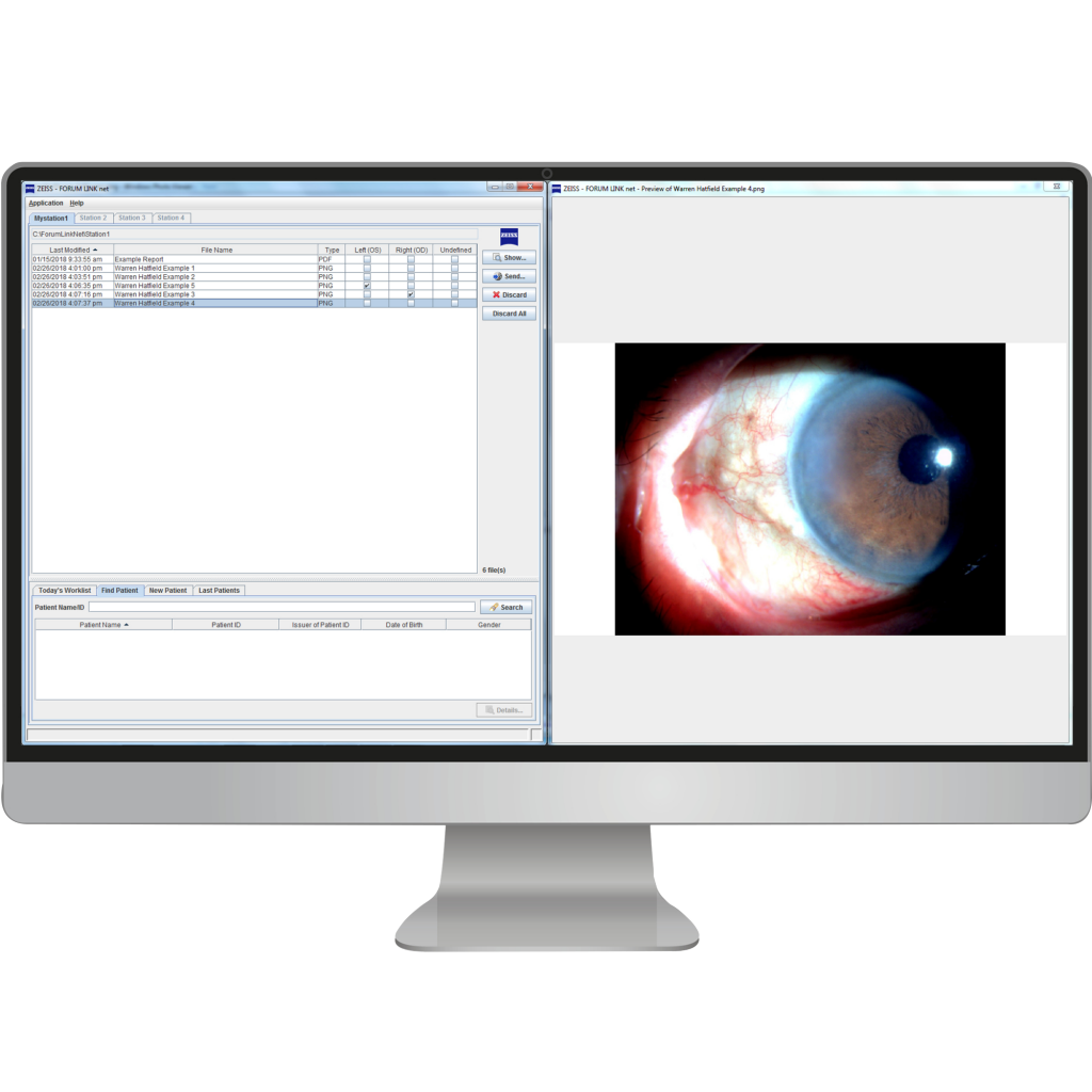 FORUM ophthalmology software
