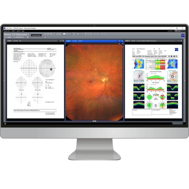 ZEISS Ophthalmology Data Management Systems