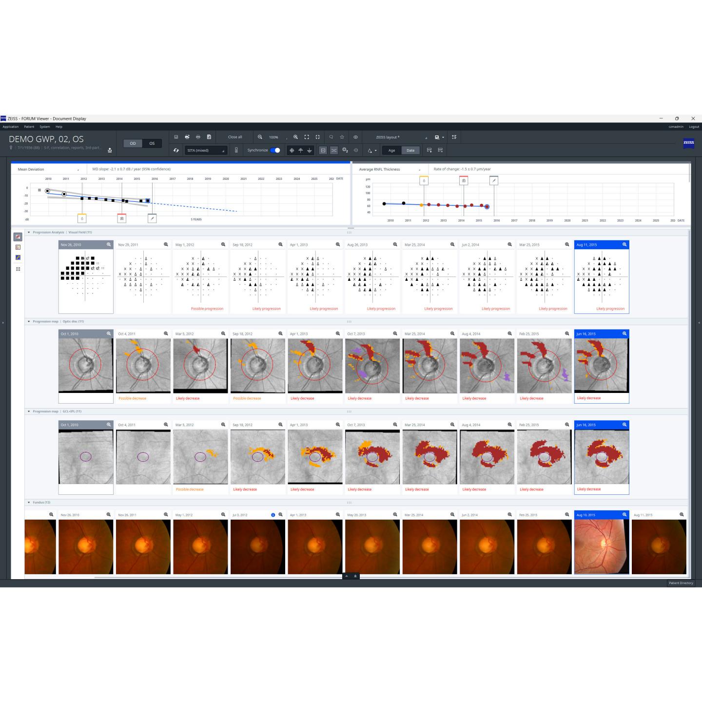 ZEISS Glaucome Workplace | ZEISS Medical Technology