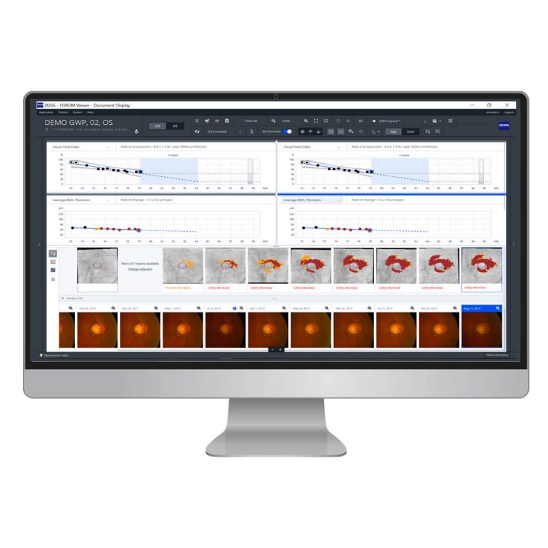 ZEISS Glaucome Workplace | ZEISS Medical Technology