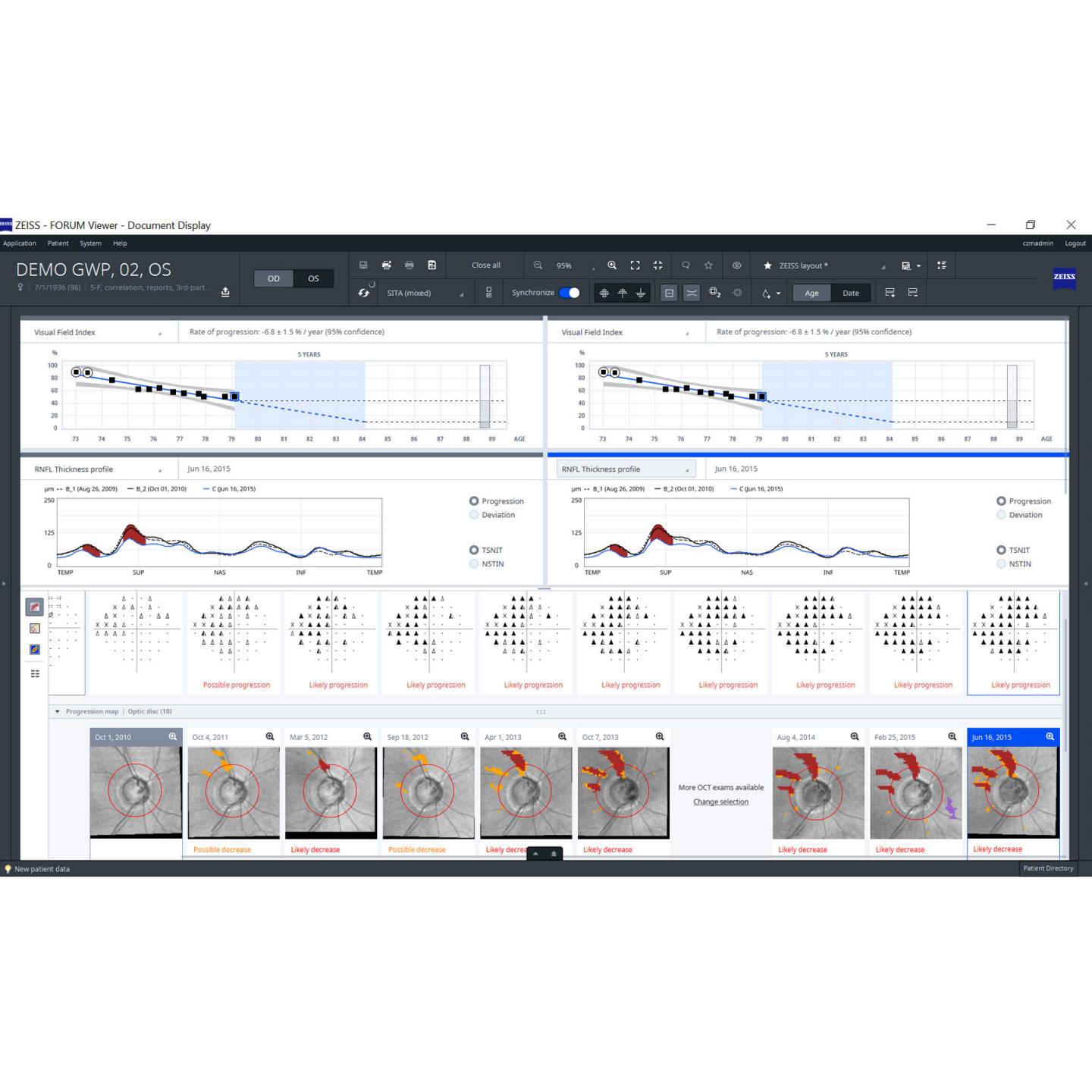 ZEISS Glaucome Workplace | ZEISS Medical Technology